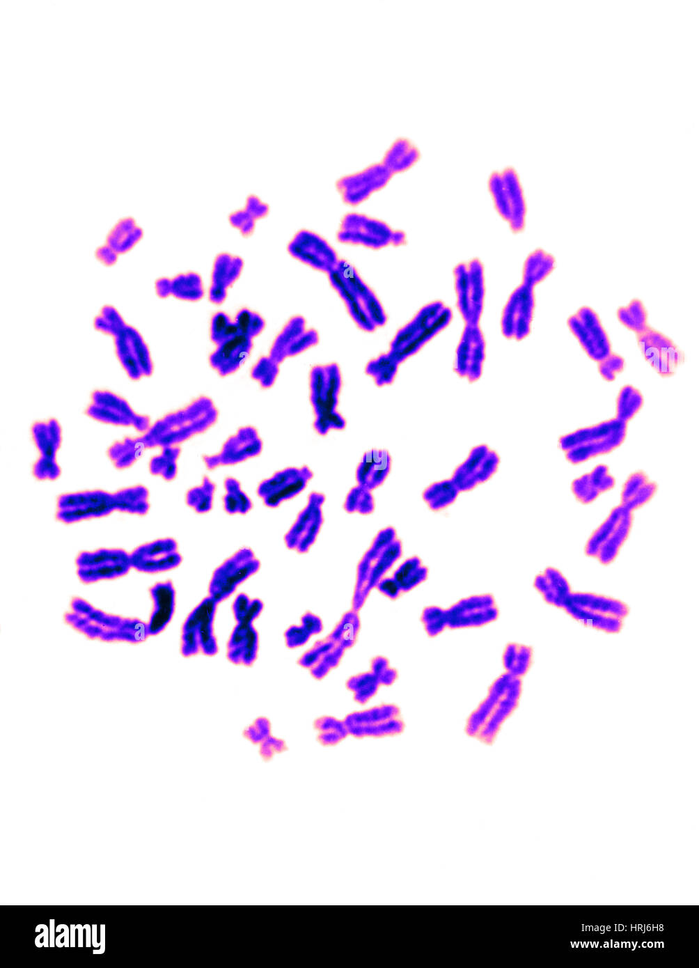 Karyotype normal hi-res stock photography and images - Alamy