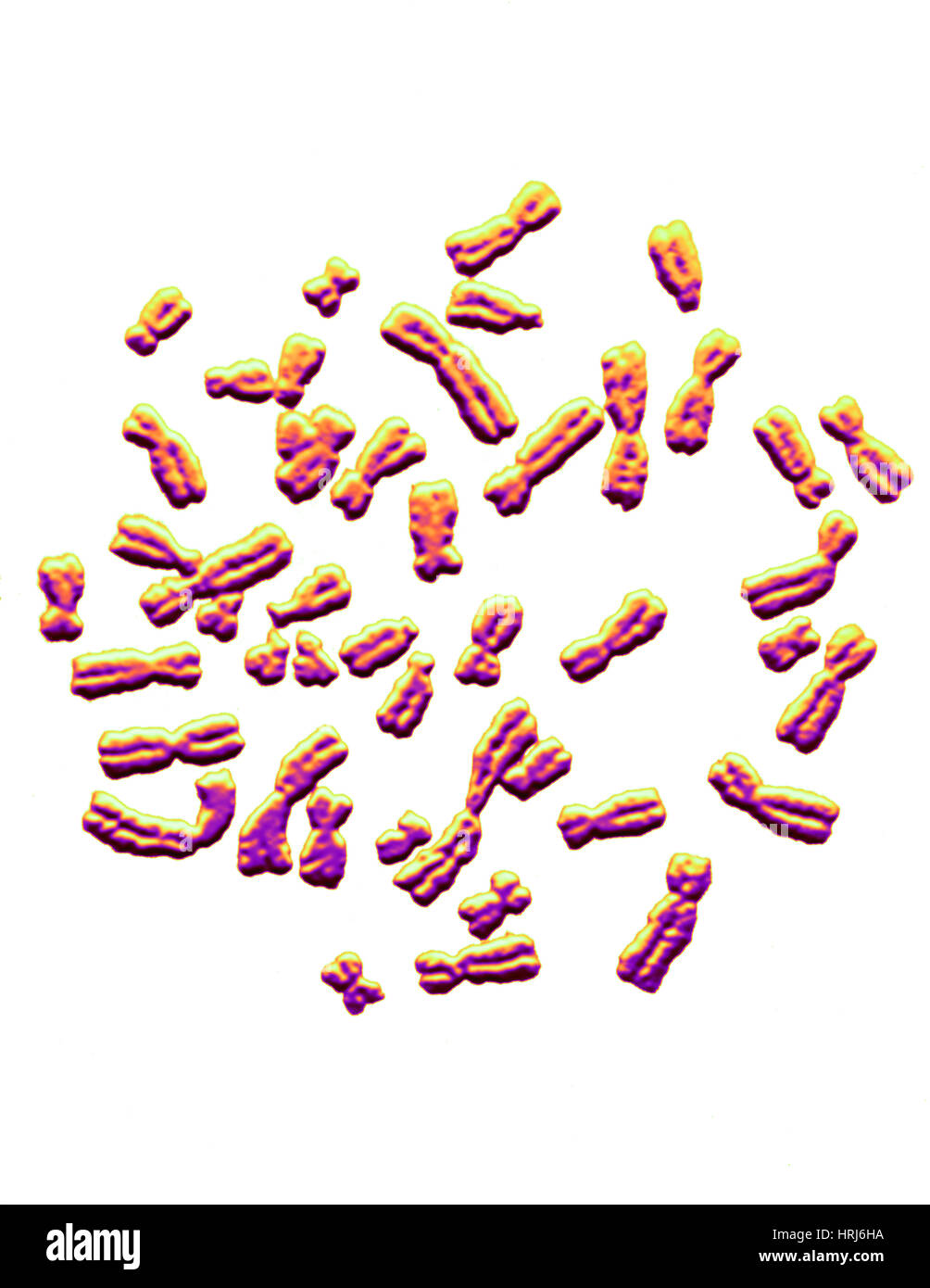 Normal female karyotype Stock Photo - Alamy
