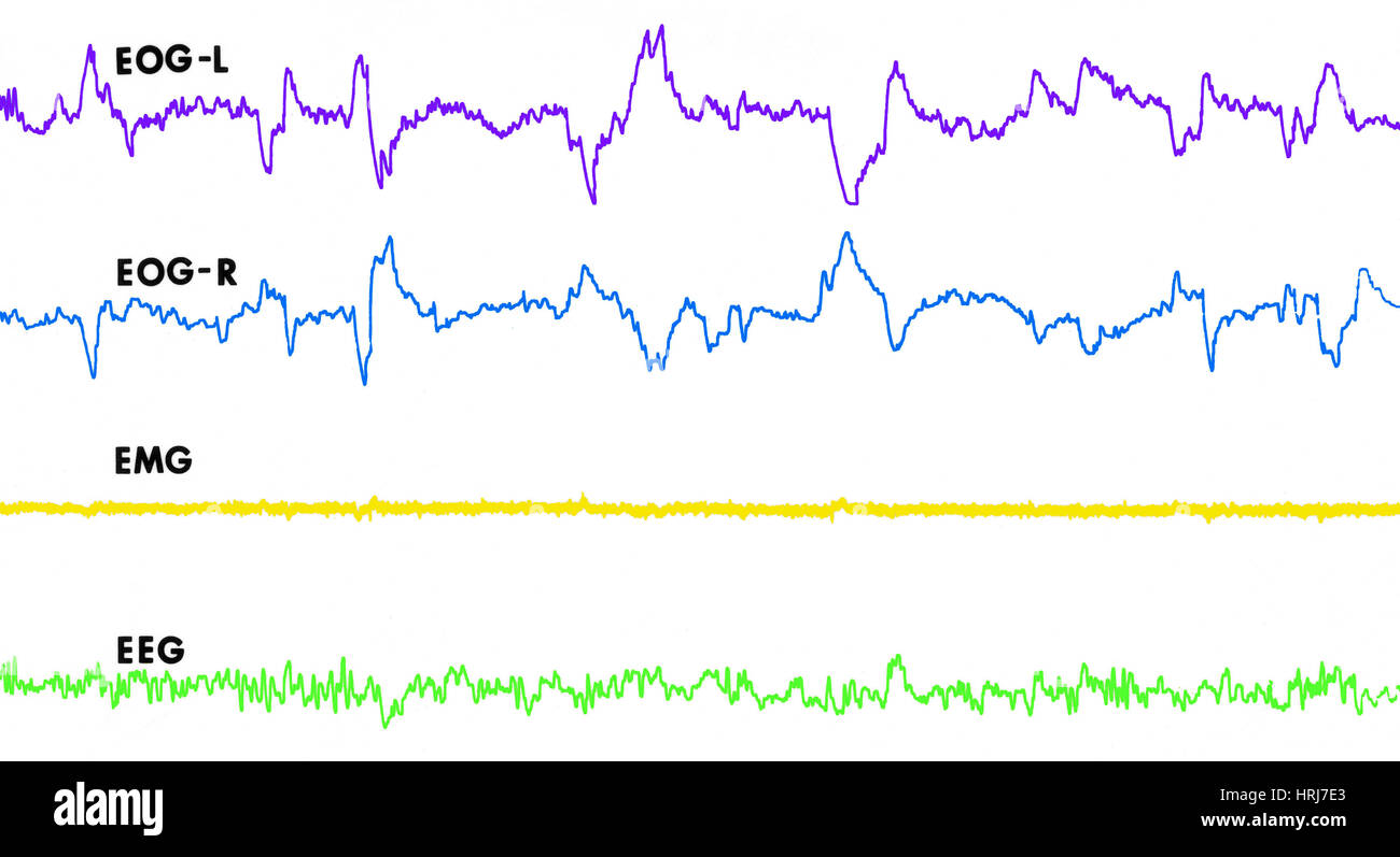 Rem sleep hi-res stock photography and images - Alamy