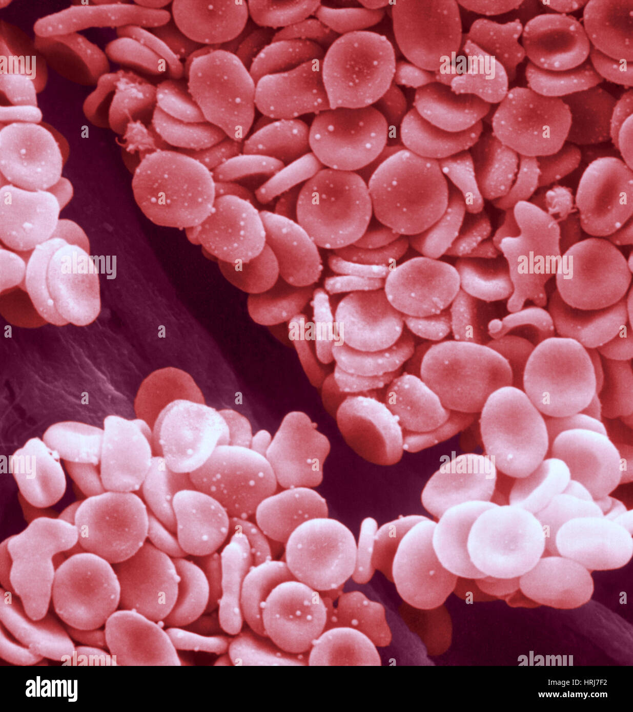 Red blood cells, SEM Stock Photo - Alamy