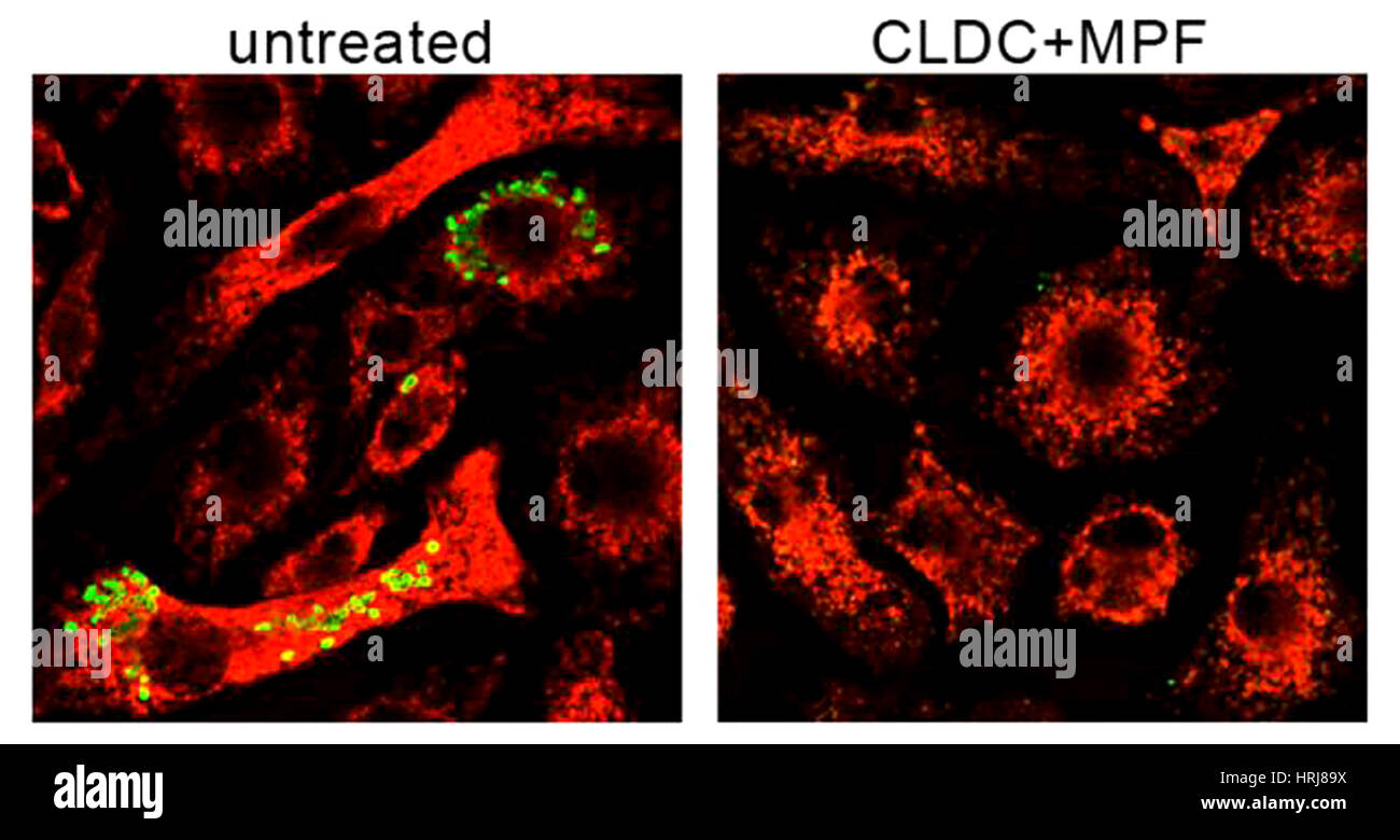 Tularemia Bacteria and Mouse Macrophages Stock Photo - Alamy