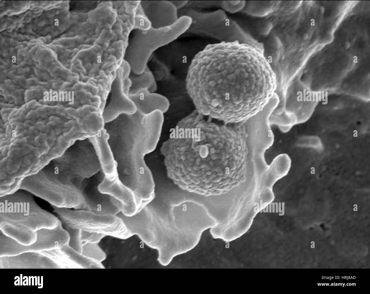 Staphylococcus aureus Bacteria, MRSA, SEM Stock Photo - Alamy Staphylococcus aureus Bacteria, MRSA, SEM Stock Photo - Alamy