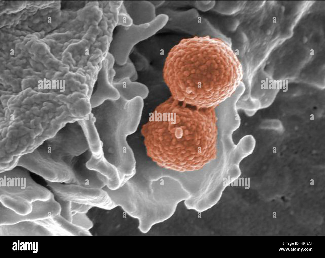 Staphylococcus aureus Bacteria, MRSA, SEM Stock Photo - Alamy Staphylococcus aureus Bacteria, MRSA, SEM Stock Photo - Alamy