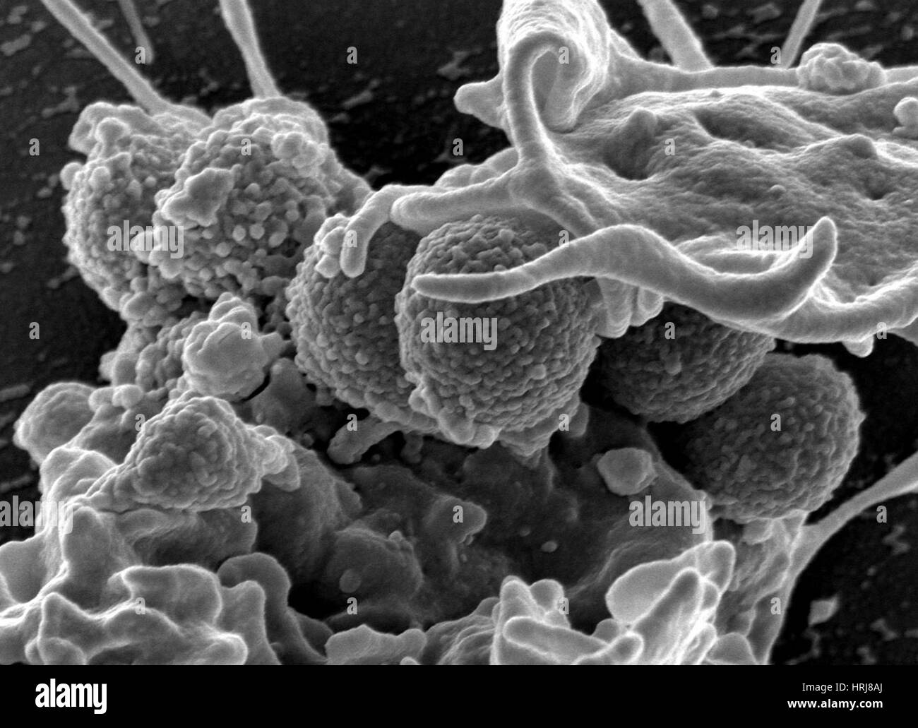 Staphylococcus aureus Bacteria, MRSA, SEM Stock Photo - Alamy Staphylococcus aureus Bacteria, MRSA, SEM Stock Photo - Alamy
