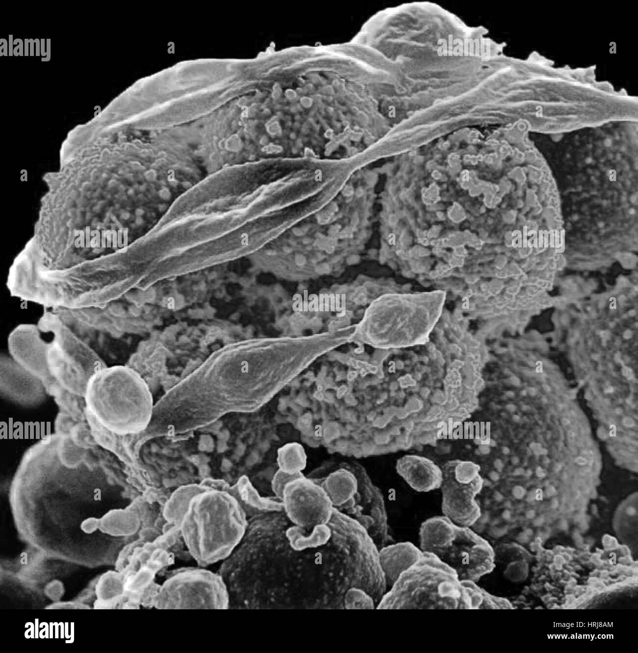 Scanning electron micrograph mrsa bacteria hi-res stock photography and ...