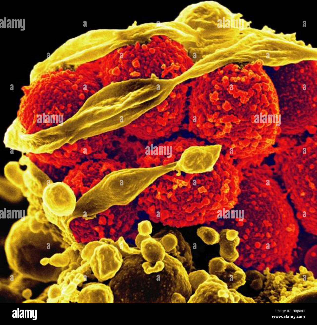 Staphylococcus aureus Bacteria, MRSA, SEM Stock Photo - Alamy
