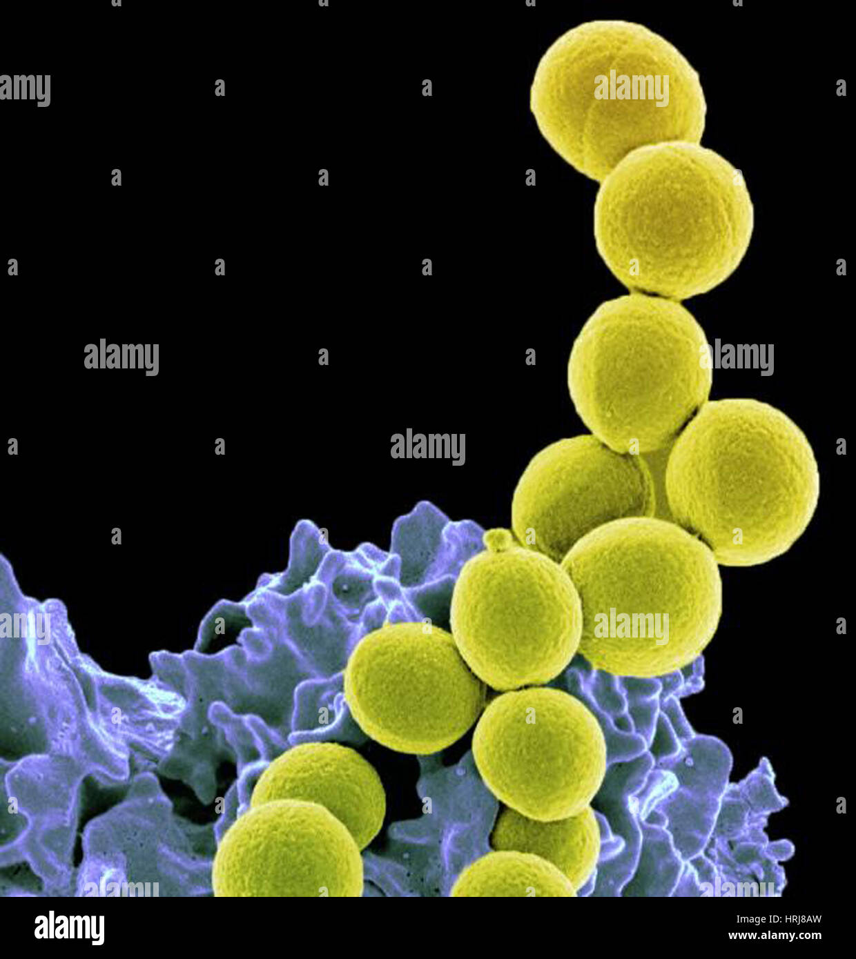 Staphylococcus Aureus Bacteria Stock Photos & Staphylococcus Aureus ...