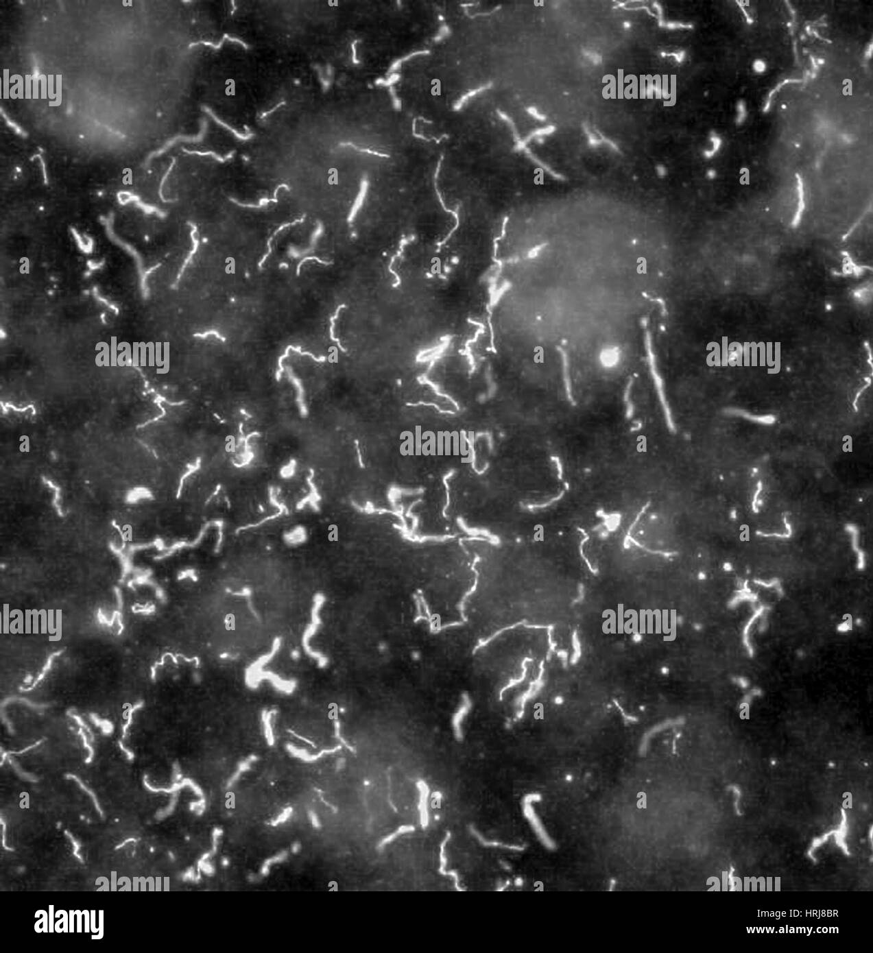 Lyme Disease, Borrelia burgdorferi Stock Photo - Alamy