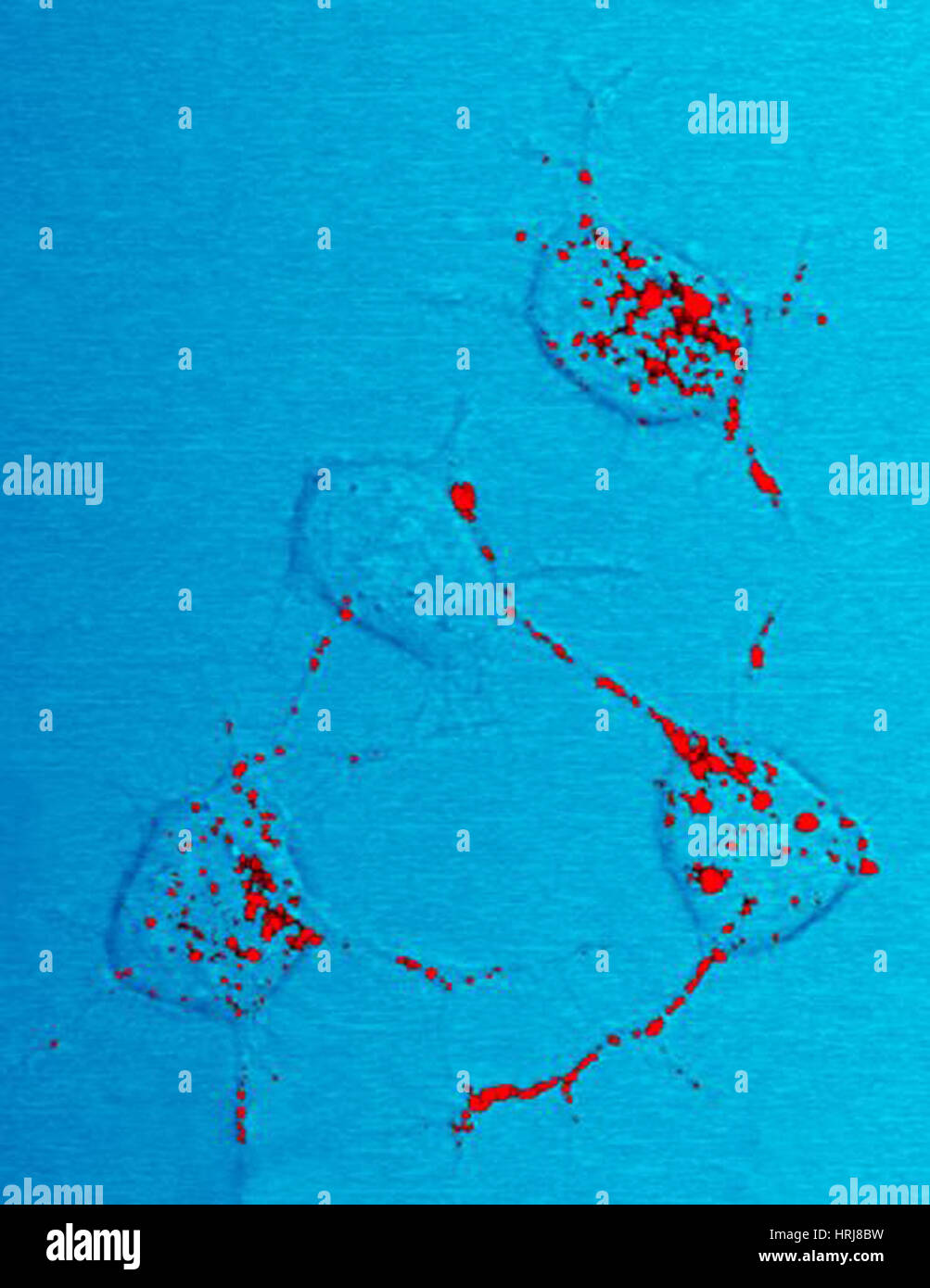 Infectious Prion Protein Stock Photo - Alamy