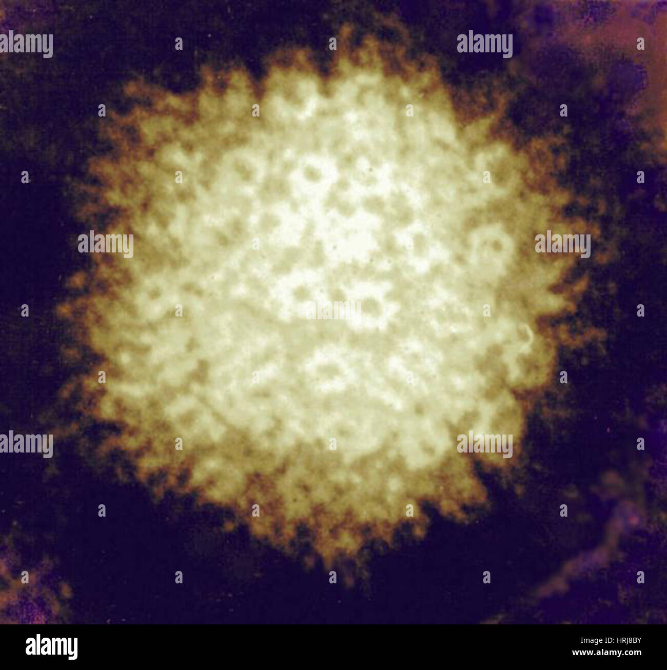 Varicella zoster micrograph hi-res stock photography and images - Alamy