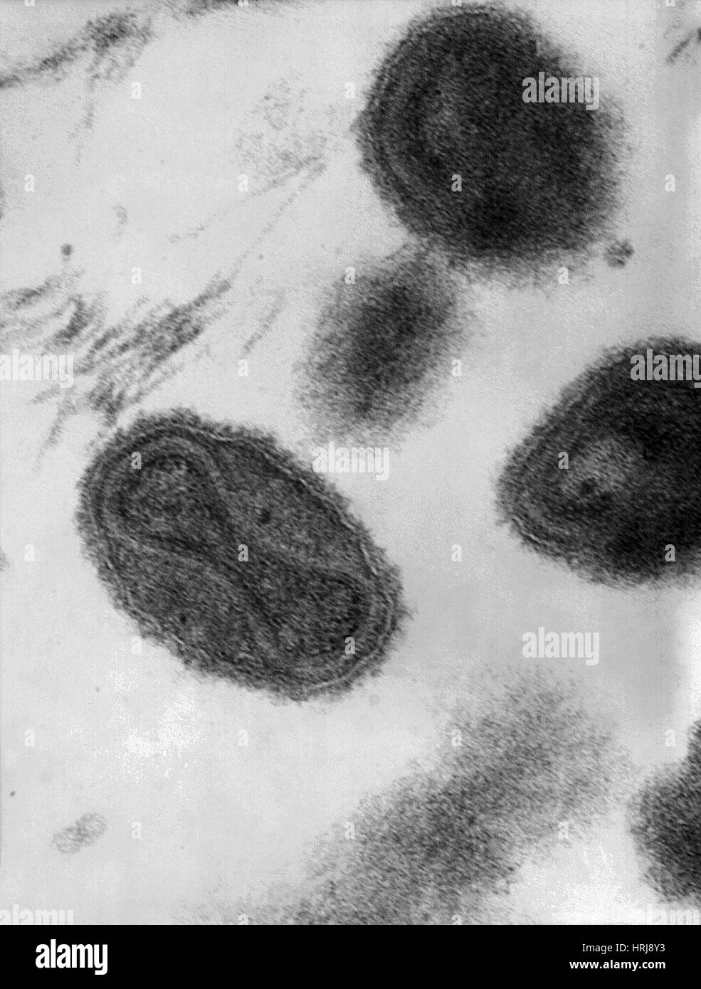 Smallpox Virus, TEM Stock Photo - Alamy