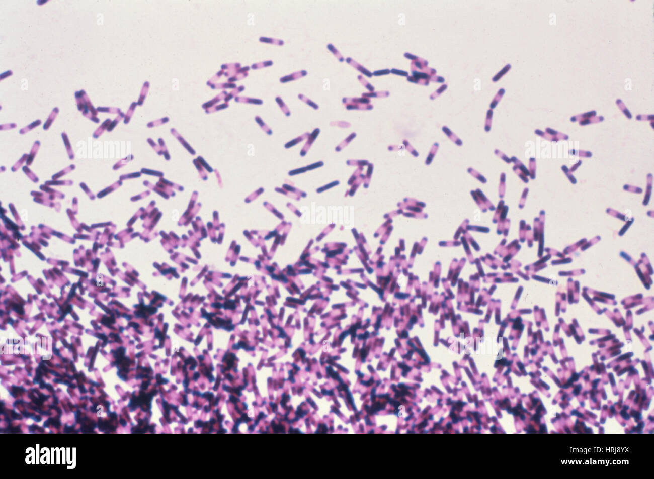 Clostridium difficile gram hi-res stock photography and images - Alamy