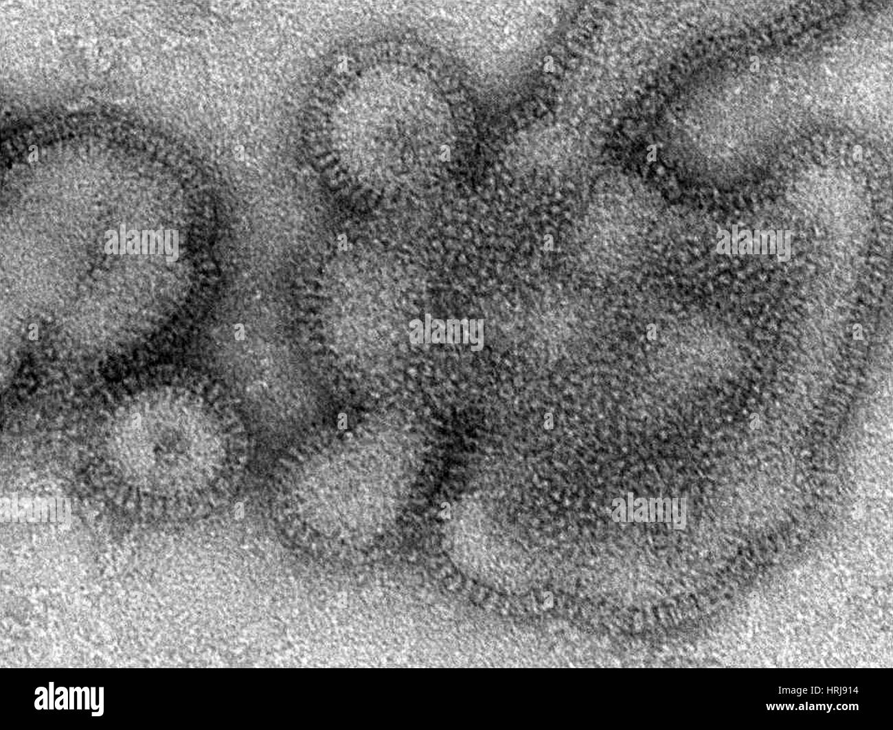 H3N2 Influenza Virus, TEM Stock Photo - Alamy