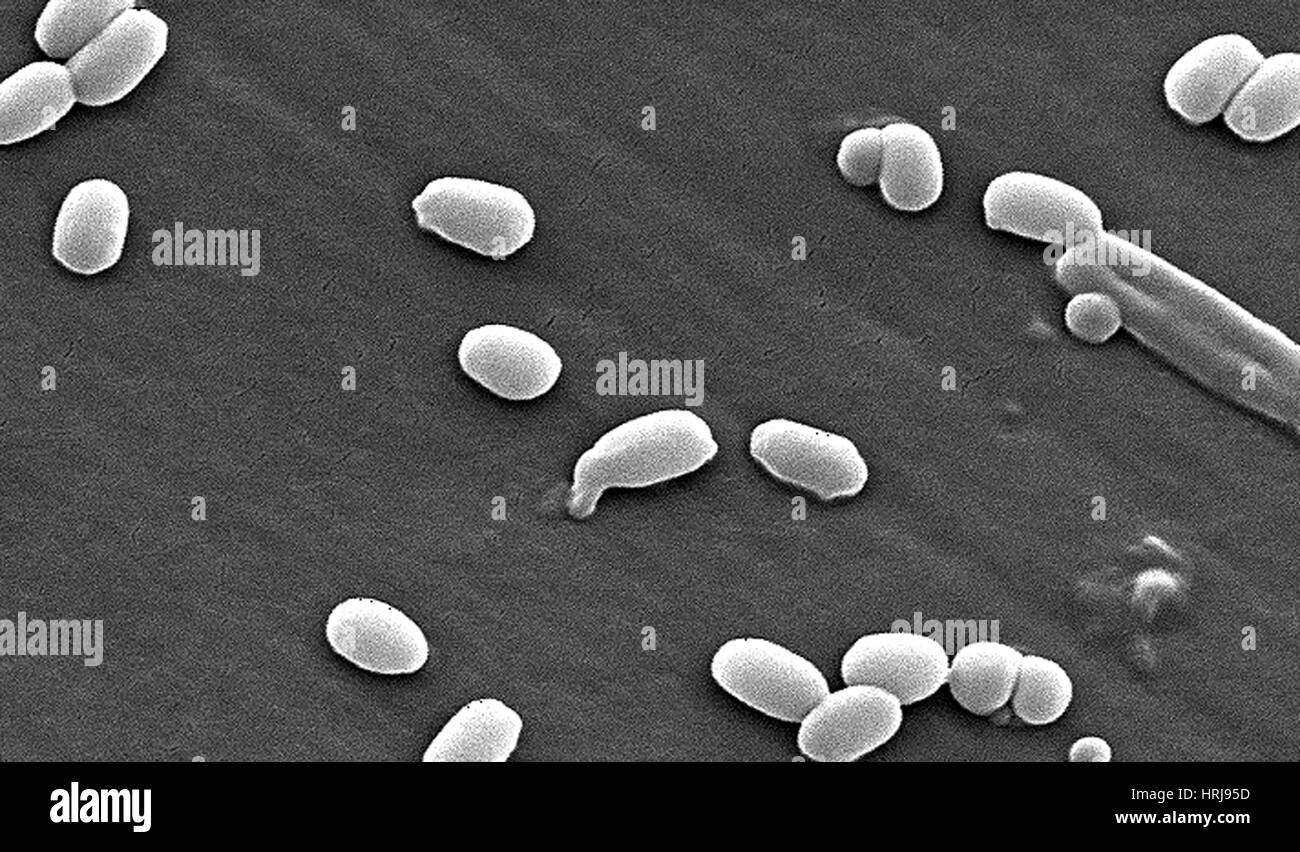 Bacillus Anthracis Micrograph High Resolution Stock Photography and ...