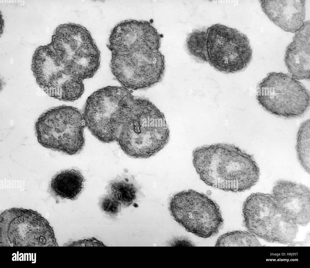 Neisseria gonorrhoeae Bacteria, EM Stock Photo - Alamy