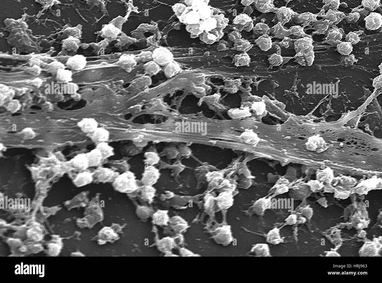 Staphylococcus aureus Bacteria, SEM Stock Photo - Alamy Staphylococcus aureus Bacteria, SEM Stock Photo - Alamy