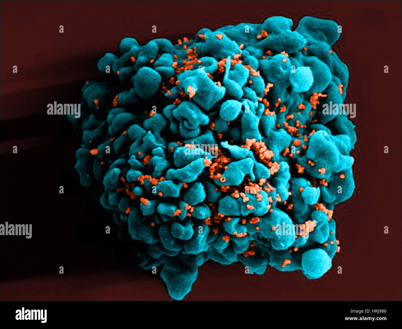 HIV-infected H9 T Cell, SEM Stock Photo - Alamy