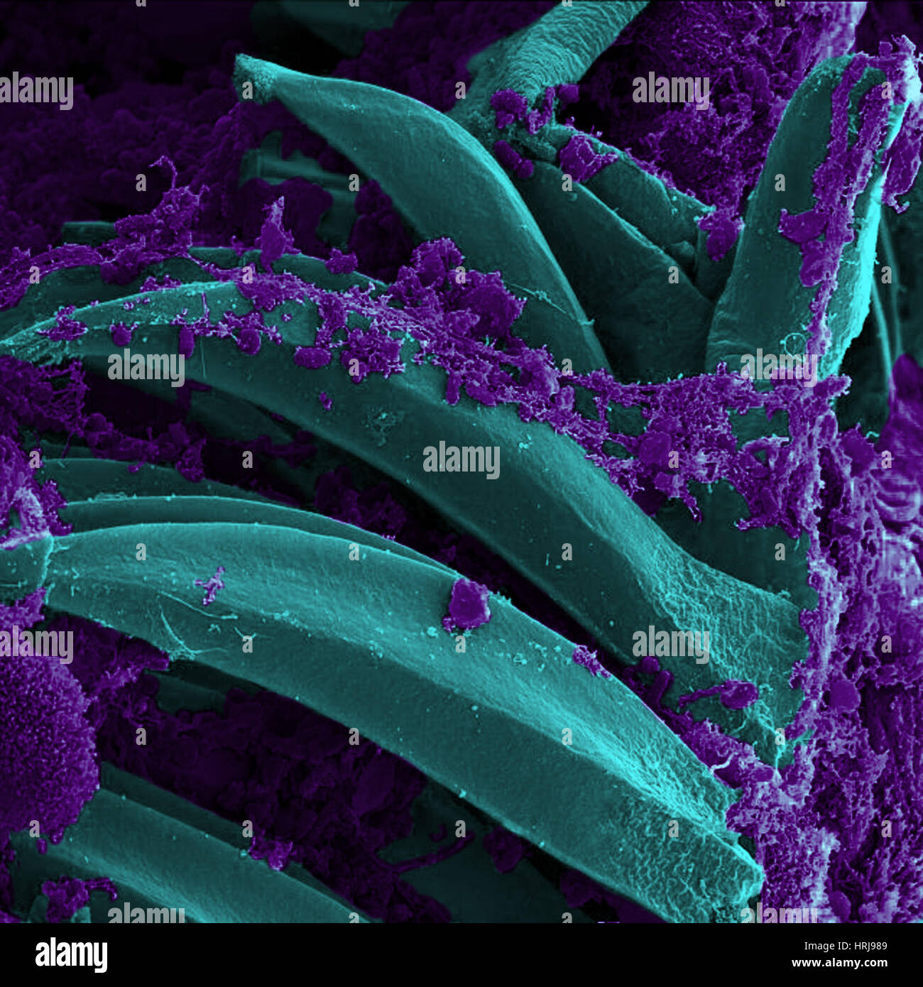 Yersinia Pestis Bacteria, SEM Stock Photo - Alamy
