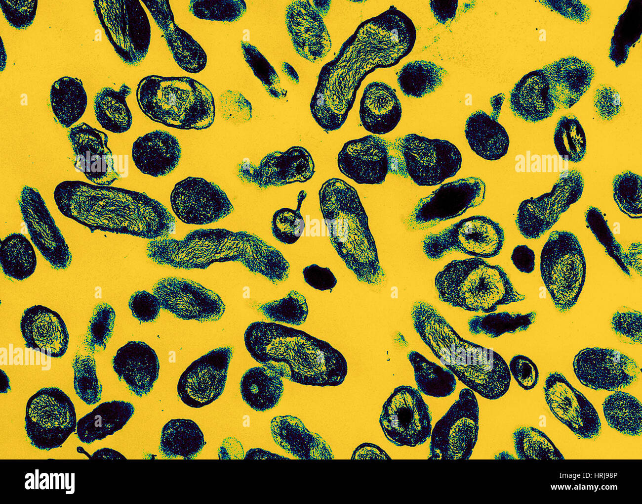 Coxiella Burnetii Bacteria, TEM Stock Photo - Alamy