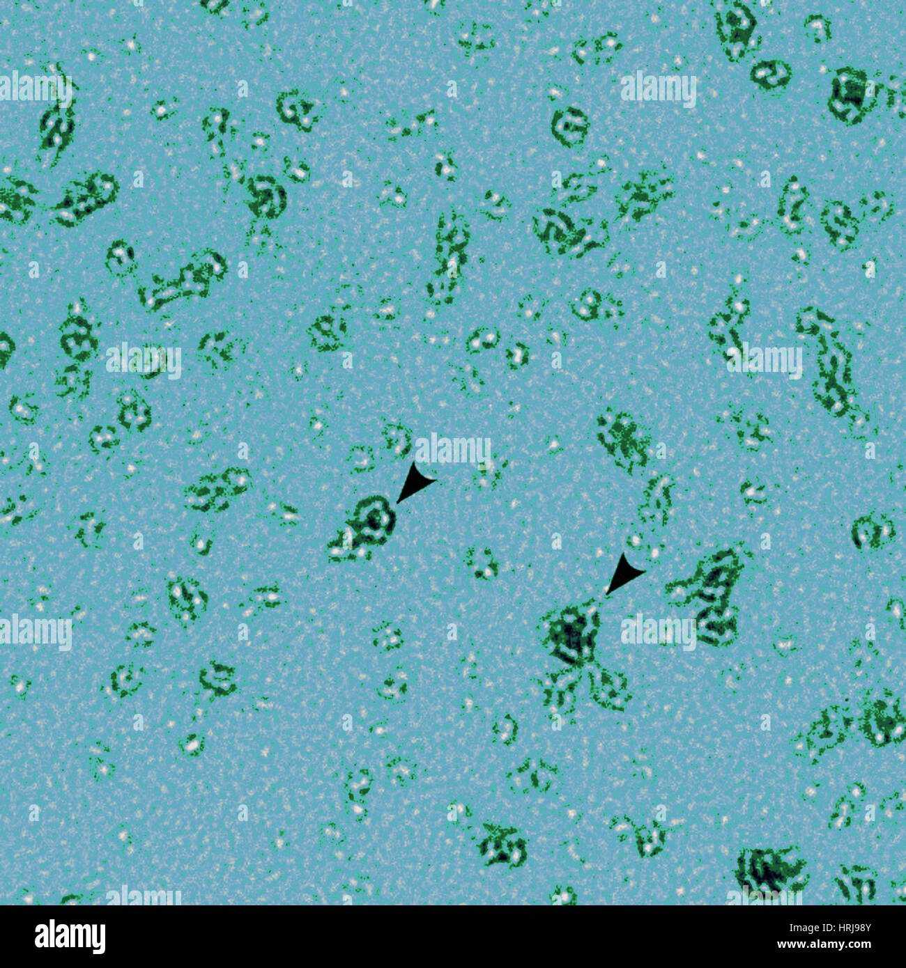 Chlamydiales hi-res stock photography and images - Alamy