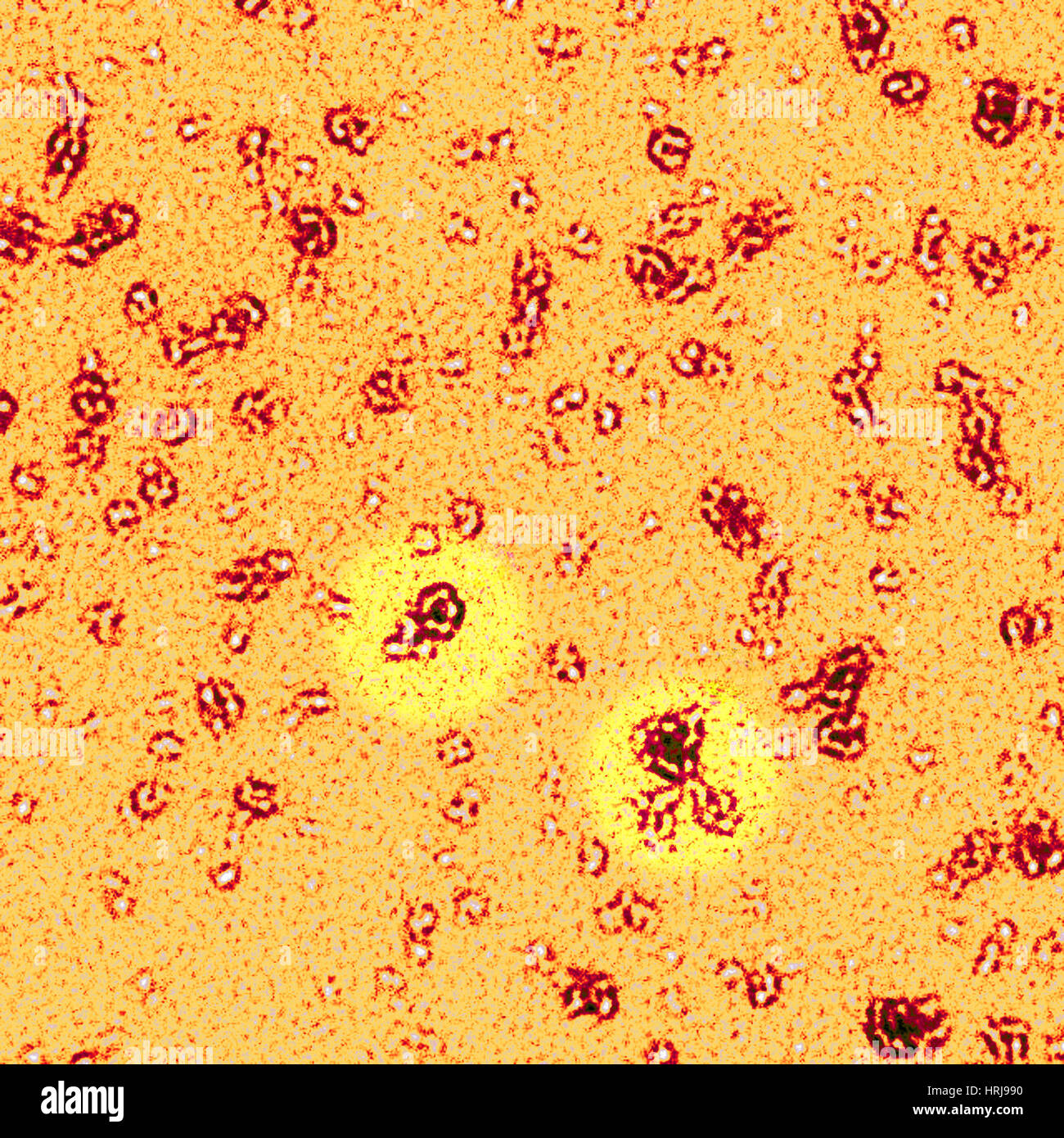 Chlamydia bacteria hi-res stock photography and images - Alamy