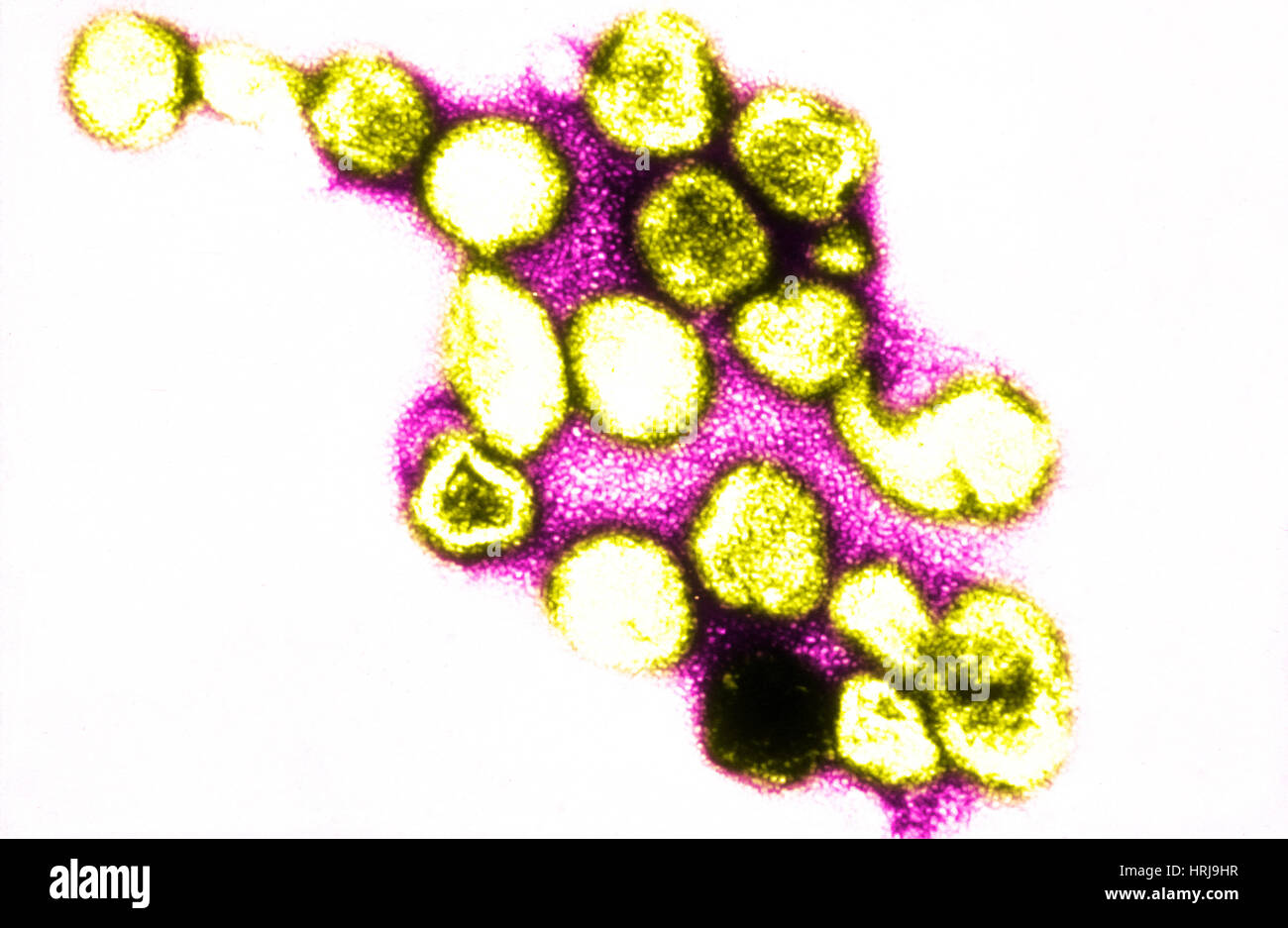 Rubella Virus, German Measles, TEM Stock Photo - Alamy