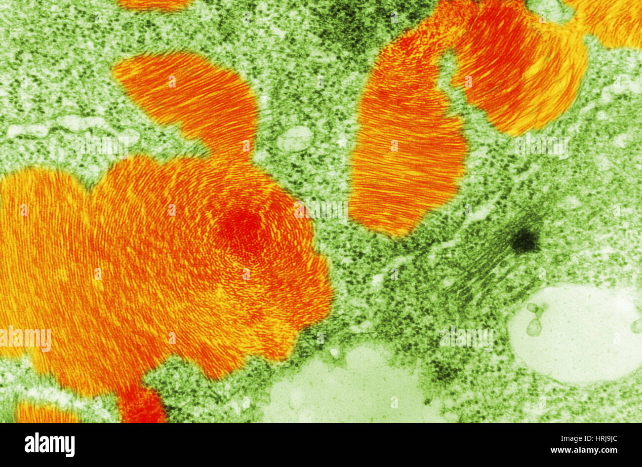 Necrotic hi-res stock photography and images - Alamy