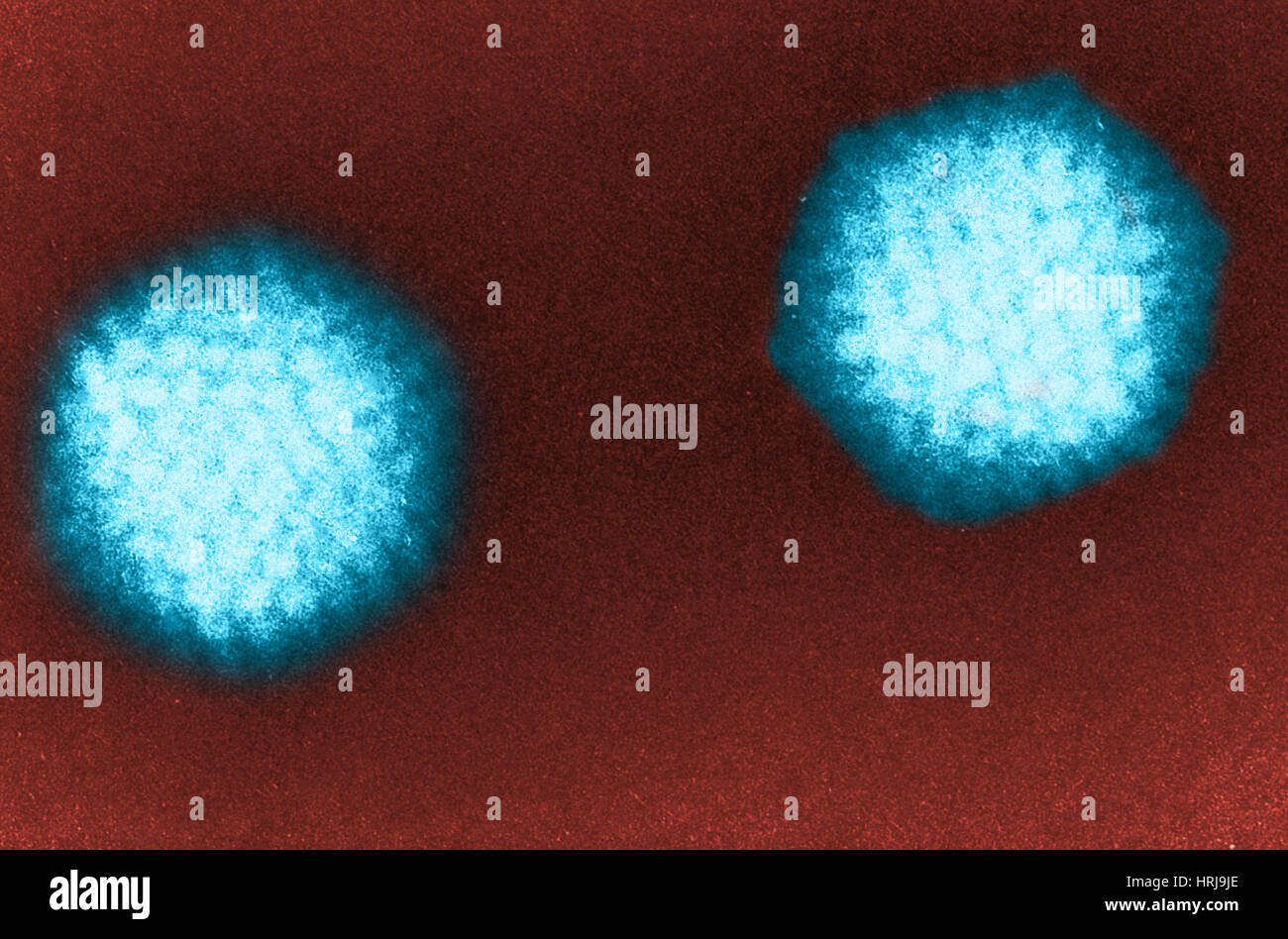Adenovirus microscopy hi-res stock photography and images - Alamy