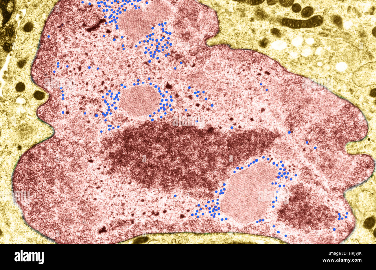 Adenovirus micrograph hi-res stock photography and images - Alamy