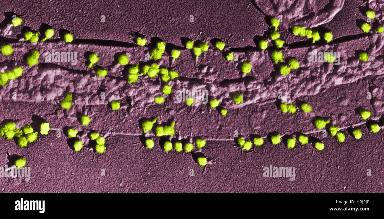 Escherichia coli bacteria cell hi-res stock photography and images - Alamy