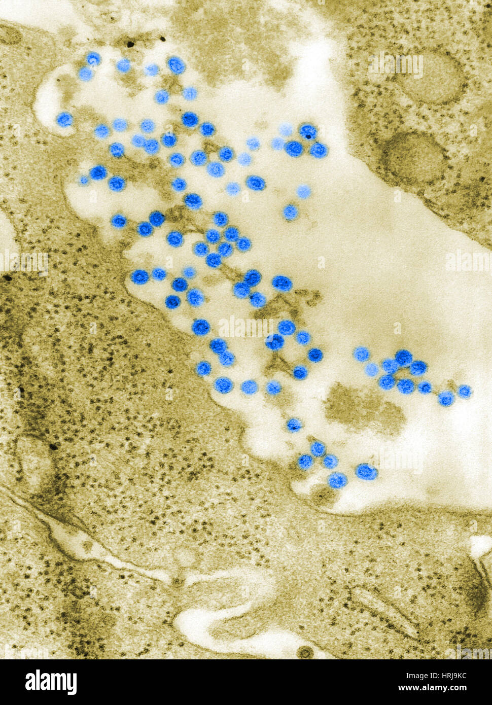 German measles virus hi-res stock photography and images - Alamy