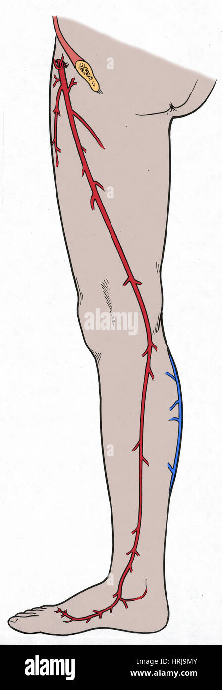 Great saphenous vein hi-res stock photography and images - Alamy