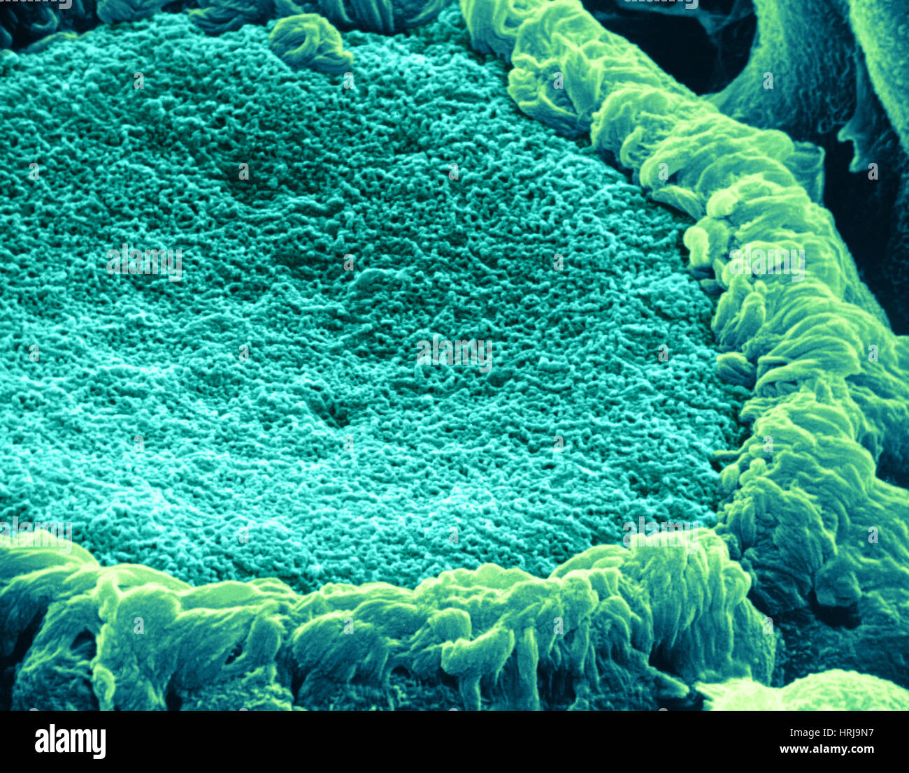 Cilia electron micrograph hi-res stock photography and images - Alamy