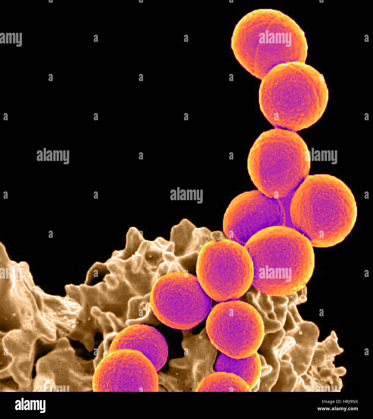 Neutrophil ingesting methicillin resistant staphylococcus aureus ...