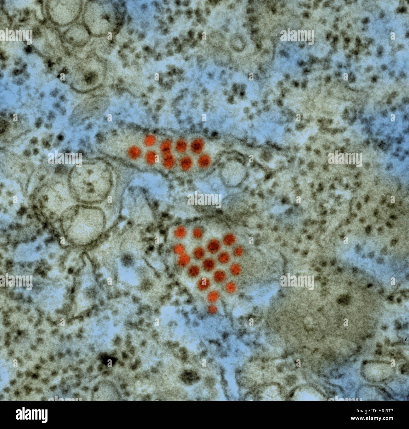 Dengue virus micrograph hi-res stock photography and images - Alamy
