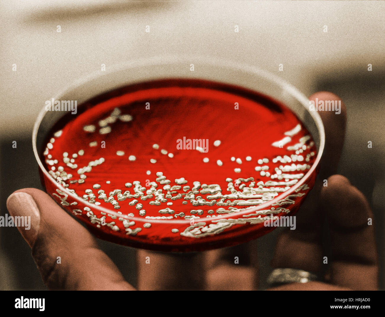Zones of inhibition hi-res stock photography and images - Alamy