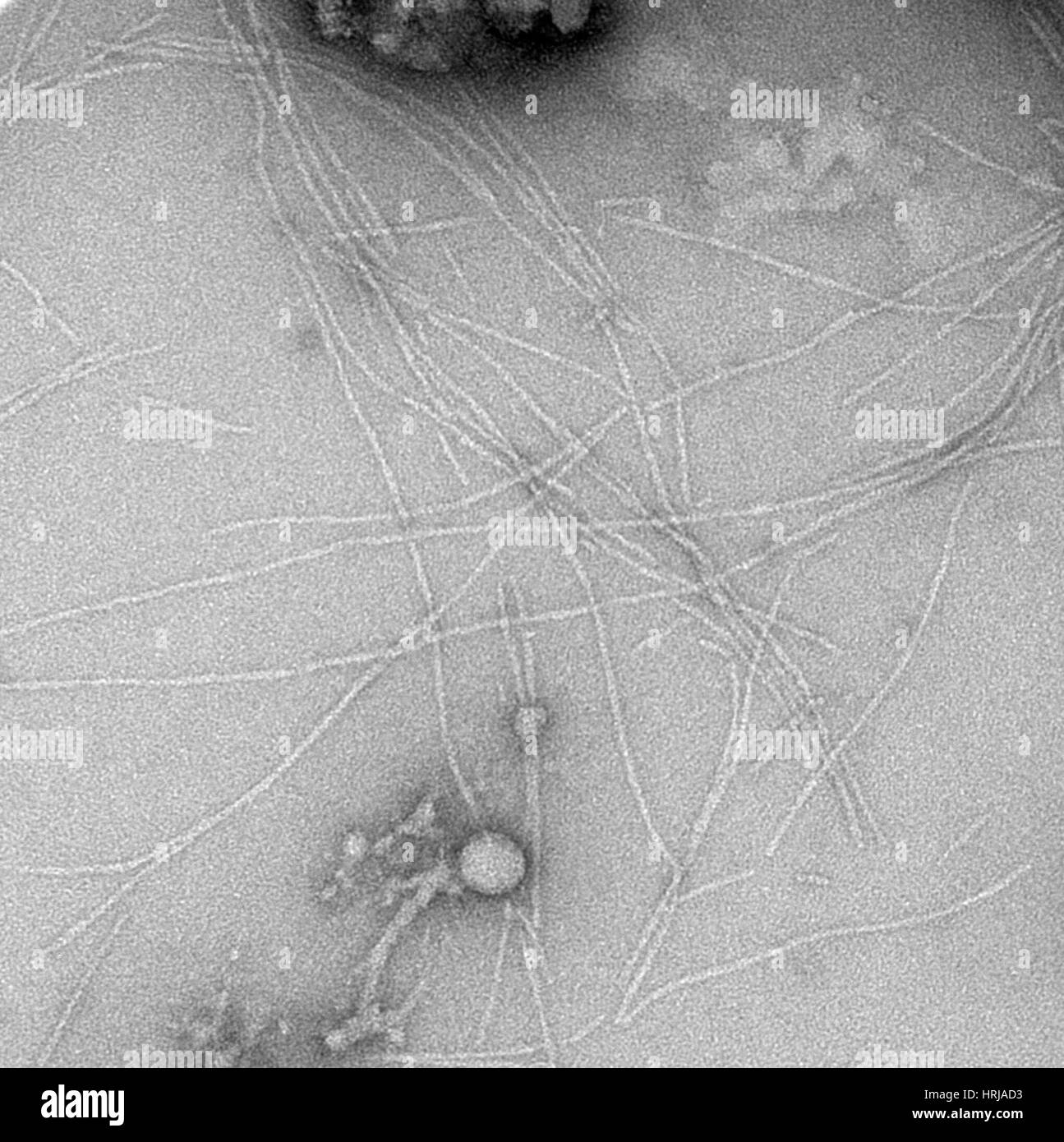 Amyloid fibril hi-res stock photography and images - Alamy