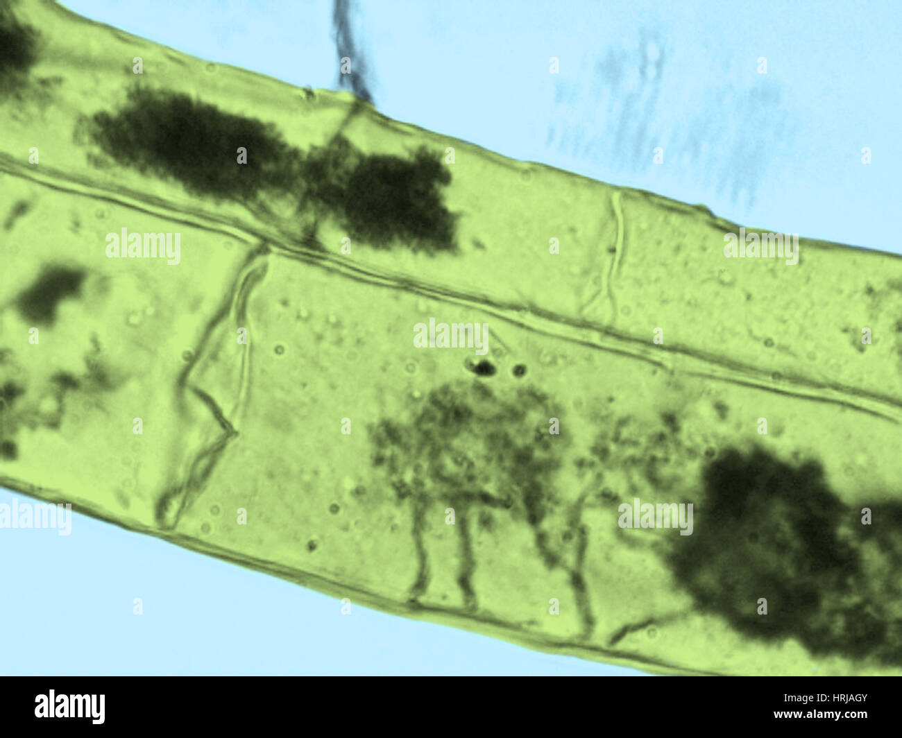 Mycorrhizae microscope hi-res stock photography and images - Alamy