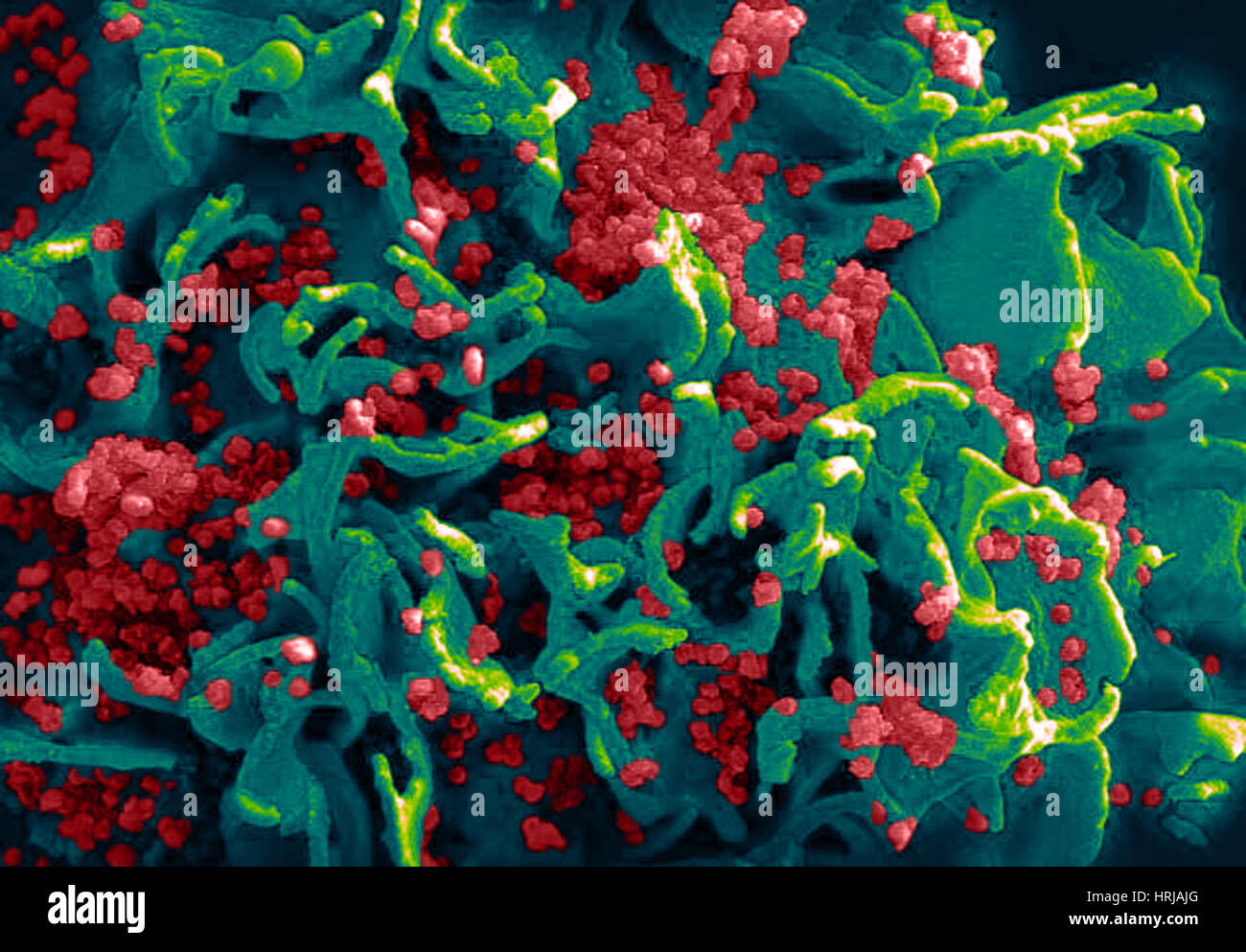 HIV-infected H9 T Cell, SEM Stock Photo - Alamy