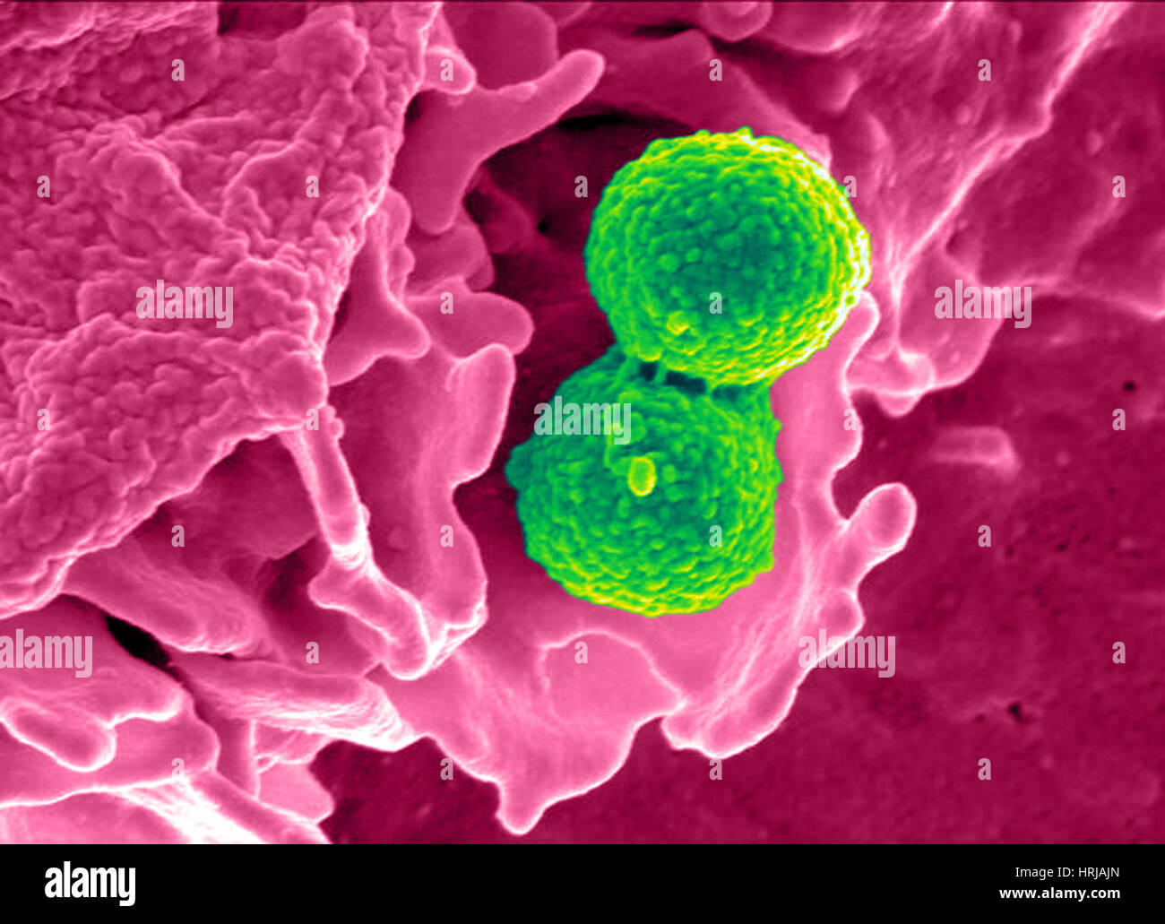 Staphylococcus species hi-res stock photography and images - Alamy