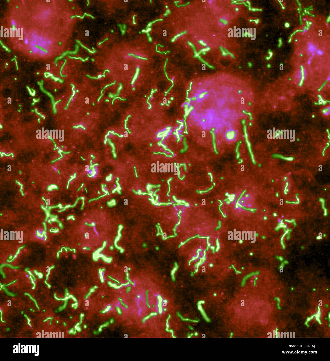 Lyme Disease, Borrelia burgdorferi Stock Photo - Alamy