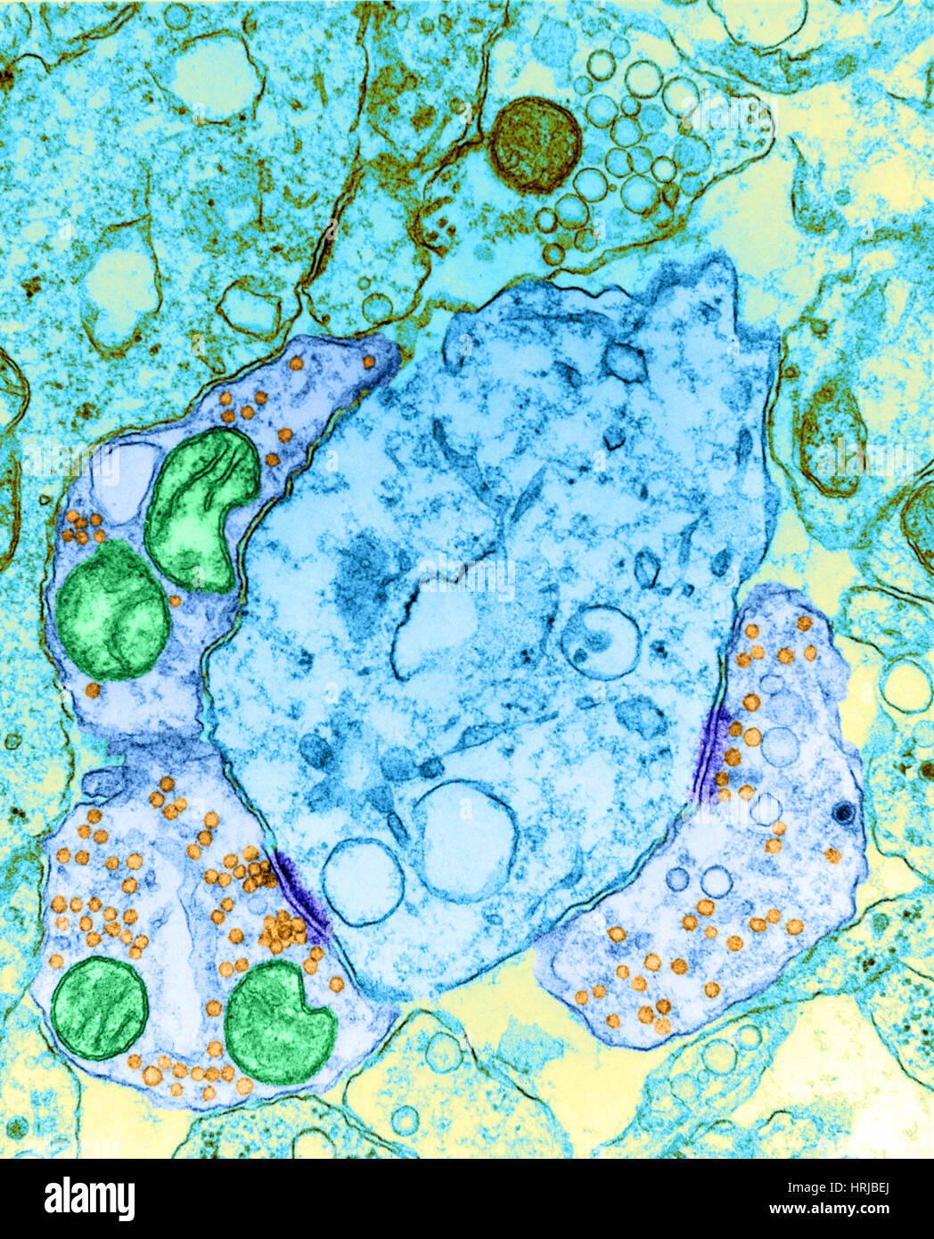 Dendrite micrograph hi-res stock photography and images - Alamy