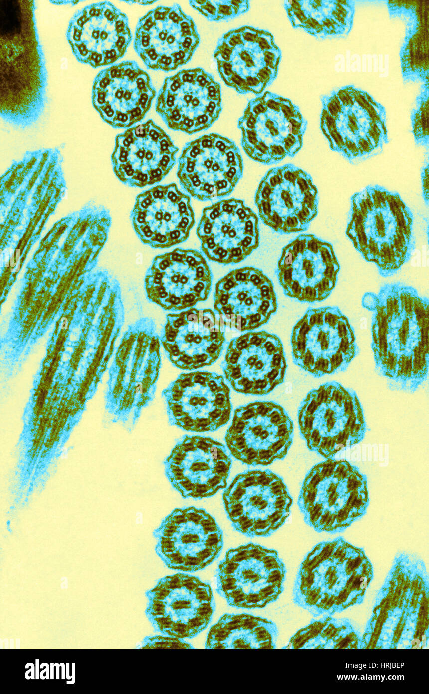 Cilia electron micrograph hi-res stock photography and images - Alamy