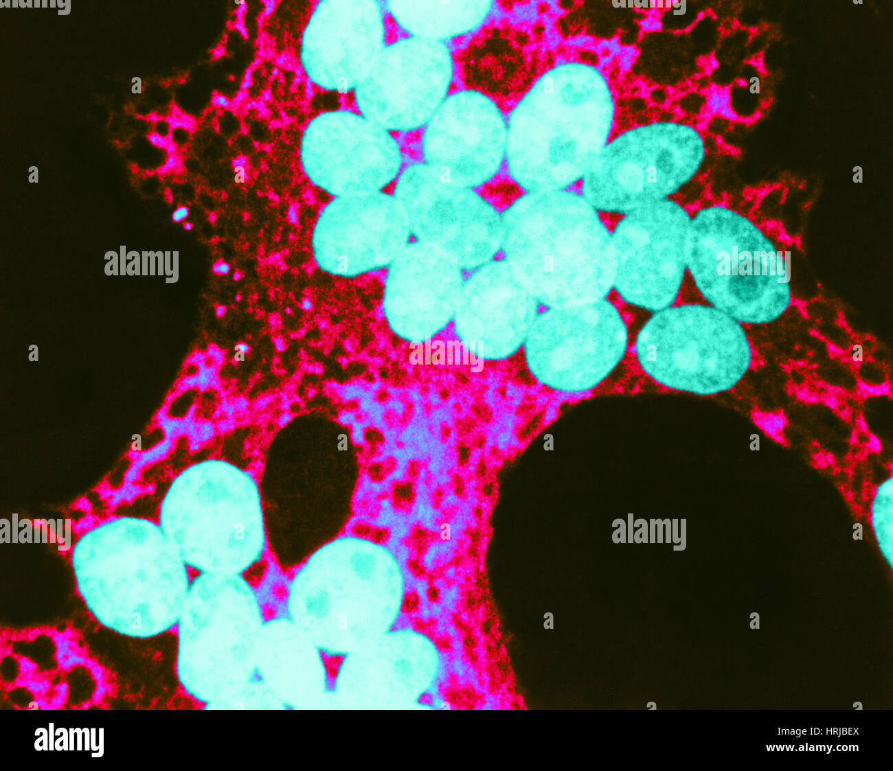 Measles virus micrograph hi-res stock photography and images - Alamy