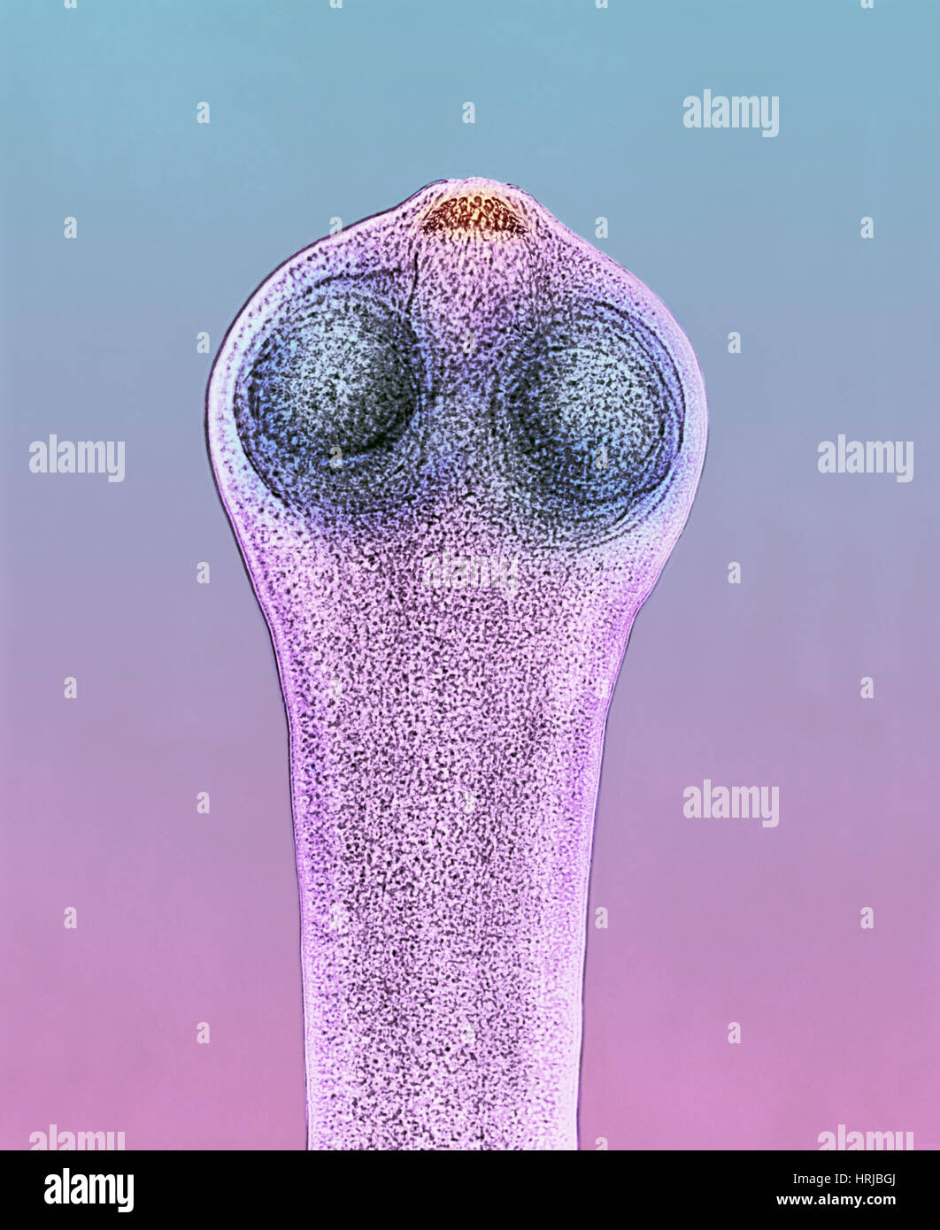 Dipylidium Caninum Labeled