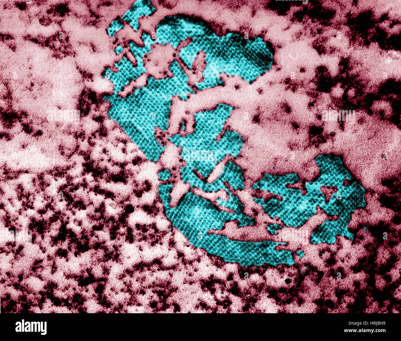 Polio virus micrograph hi-res stock photography and images - Alamy