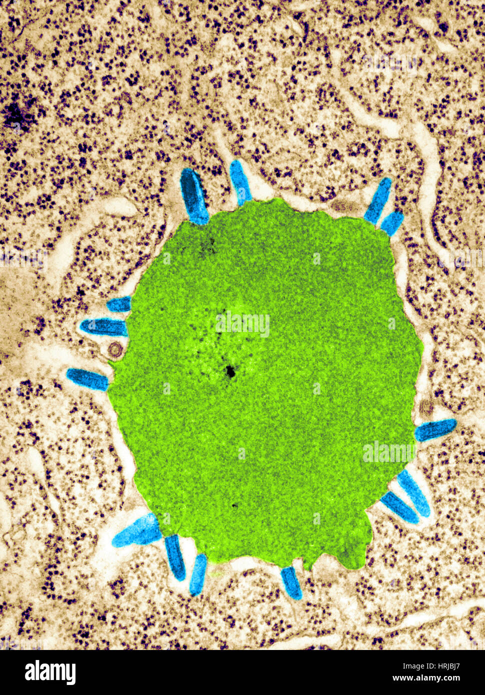 Viral inclusion body hi-res stock photography and images - Alamy