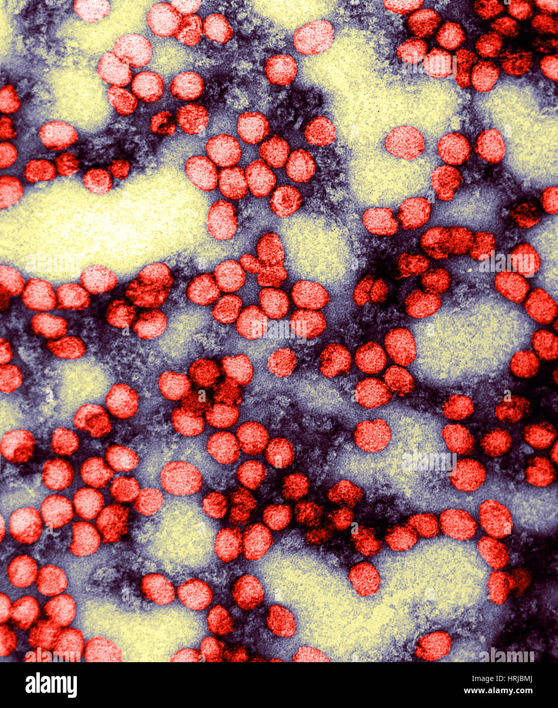 Yellow Fever Virus, TEM Stock Photo - Alamy