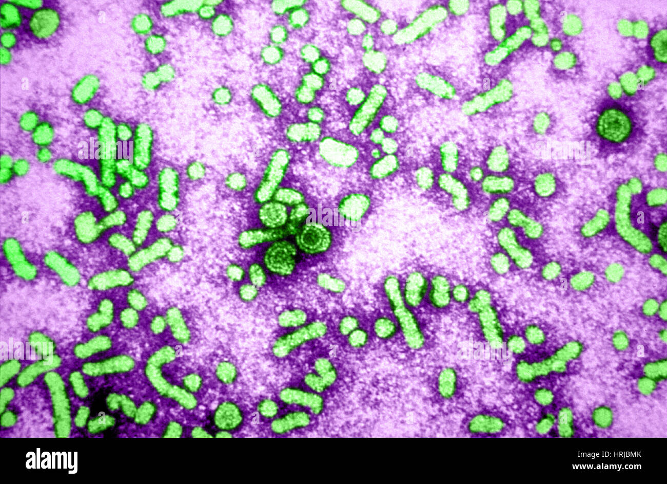 Hepatitis-B Virus, TEM Stock Photo - Alamy