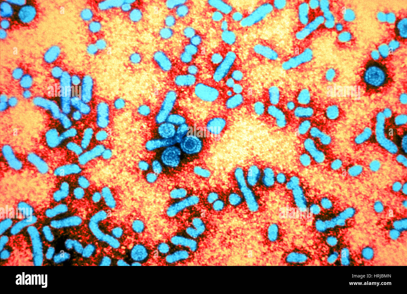 Hepatitis-B Virus, TEM Stock Photo - Alamy